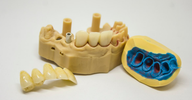 Best types of dentures to get and their benefits